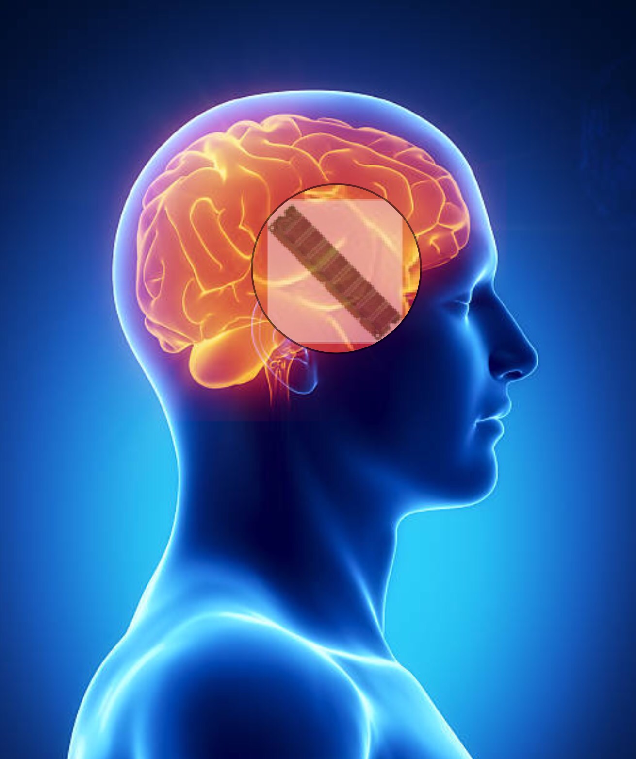 Age-related Memory Loss: Filipino Scientists Suggest RAM Brain Implant ...