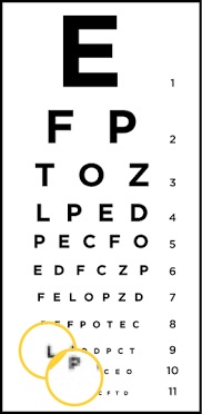 Optometrist Association of the Philippines Develops New Eye Test for ...